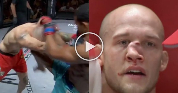 Le nez complètement détruit, il demande à l’arbitre de continuer le ...